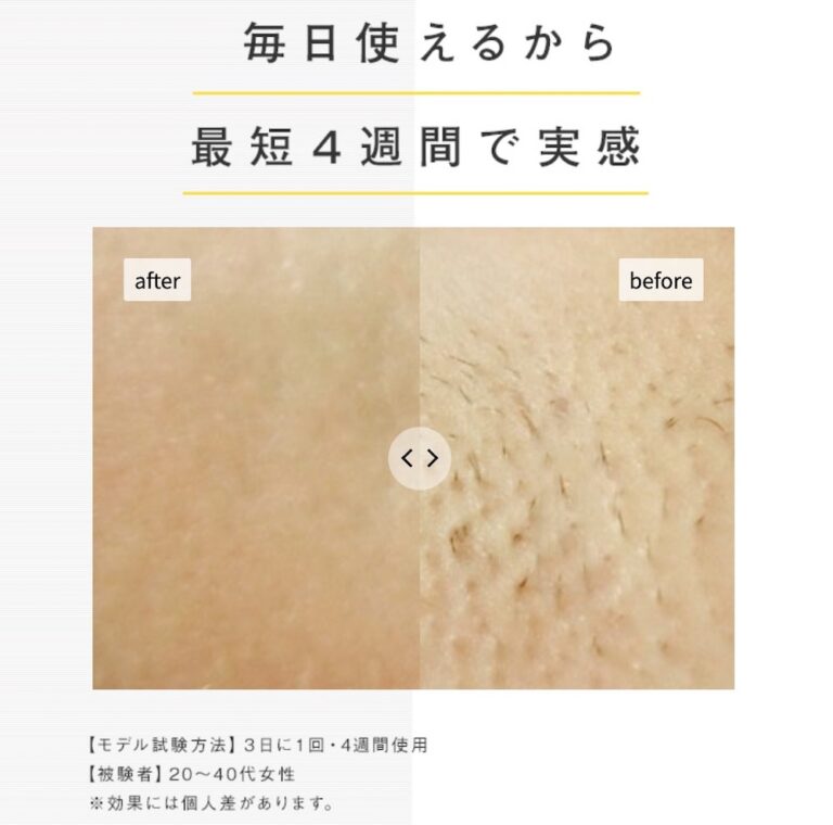 JOVS脱毛器は毎日使っても大丈夫？JOVS Doraの最適な使用頻度を解説 | ヒゲペディア